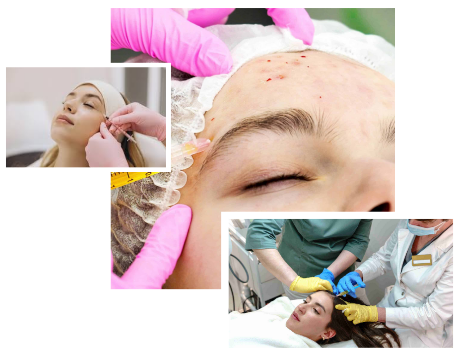 Autologous Blood–Derived Regenerative Exosomes & Stem Cells