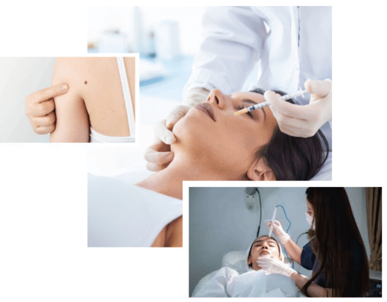 Curettage and Cautery in London